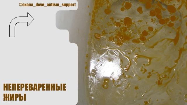 АУТИЗМ. НЕПЕРЕВАРЕННЫЕ ЖИРЫ