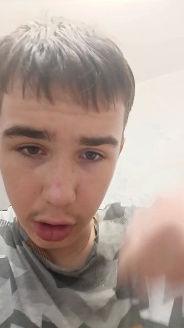 Жорику плохо😰😡😩😔😥 часть 2