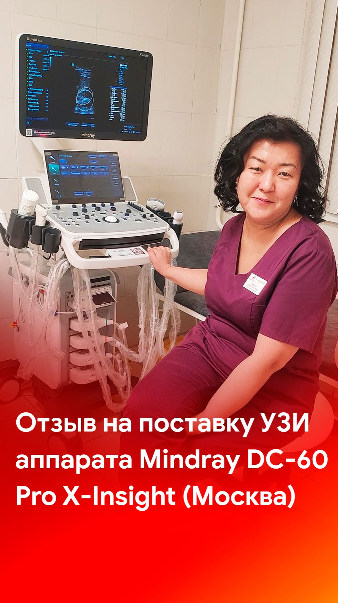 Отзыв на поставку УЗИ аппарата Mindray DC-60 Pro X-Insight (Москва)