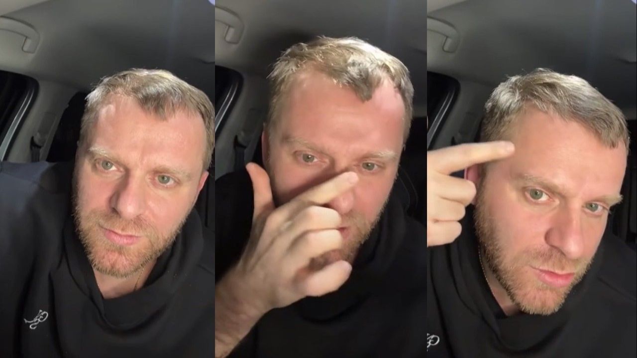 Переборщил с Косметикой- Мазюкал Все Подряд- Слазит Кожа- Что Делать- Самвел Адамян