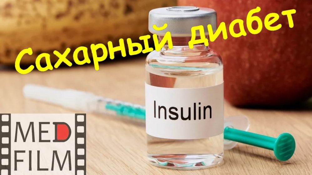 Сахарный диабет © Diabetes mellitus