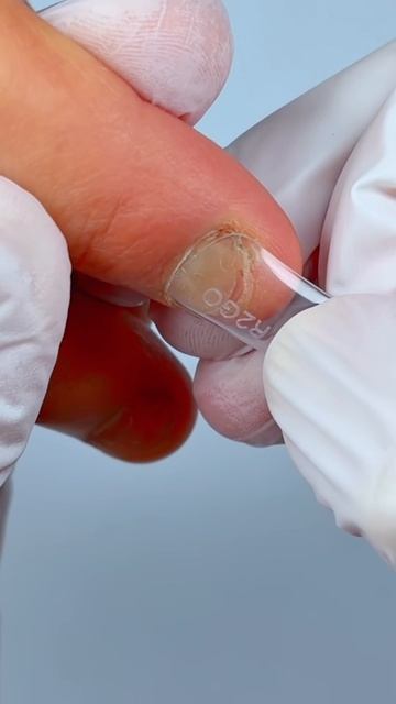 стесняется своих рук, но грызет ногти  исправляем  полное видео с результатом есть у меня в профиле