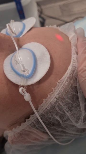 Жемчужный пилинг. Техника выполнения