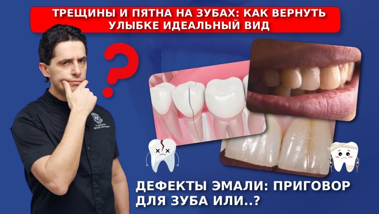 Трещины и пятна на зубах: как вернуть улыбке идеальный вид