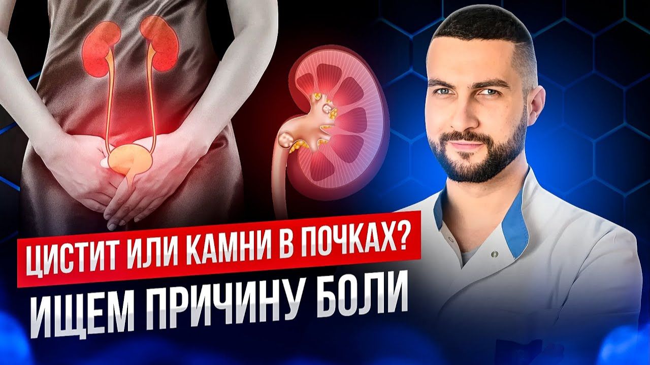 Разница в симптомах цистита и камней в почках