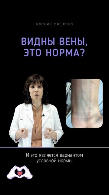 ВИДНЫ ВЕНЫ, ЭТО НОРМА? 😼🫶😎