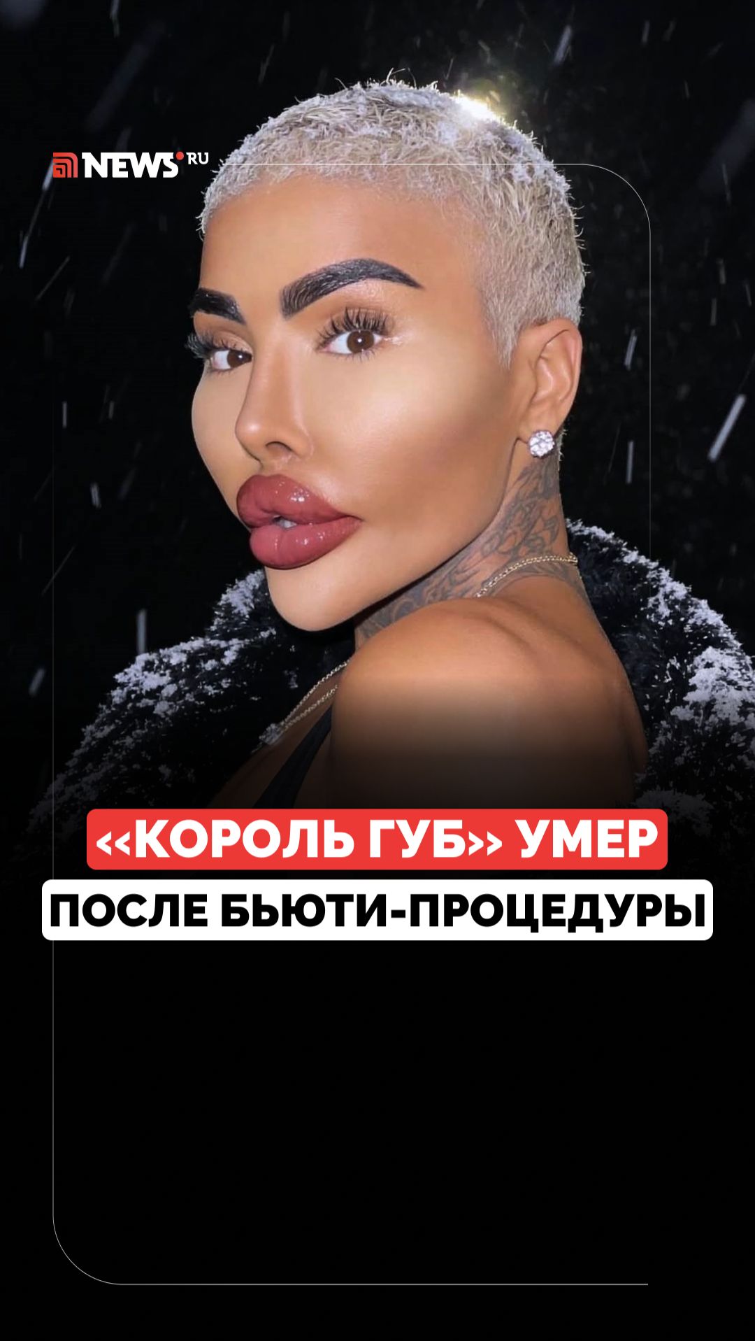 Эта процедура стала последней. В Британии скончался «король губ»