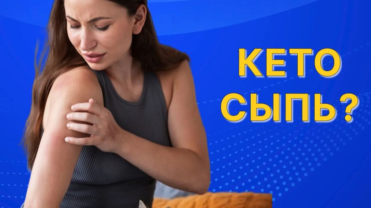 Кето сыпь: причины появления, способы решения проблемы.