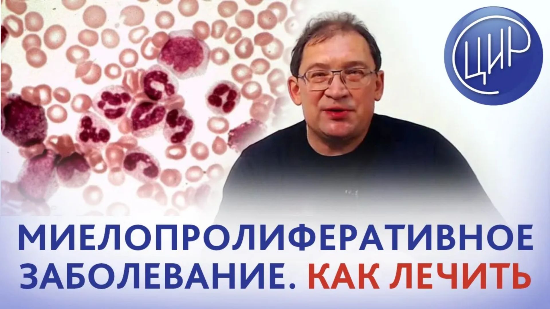 Миелопролиферативное заболевание, беременность и интерферон альфа. Гузов И.И.