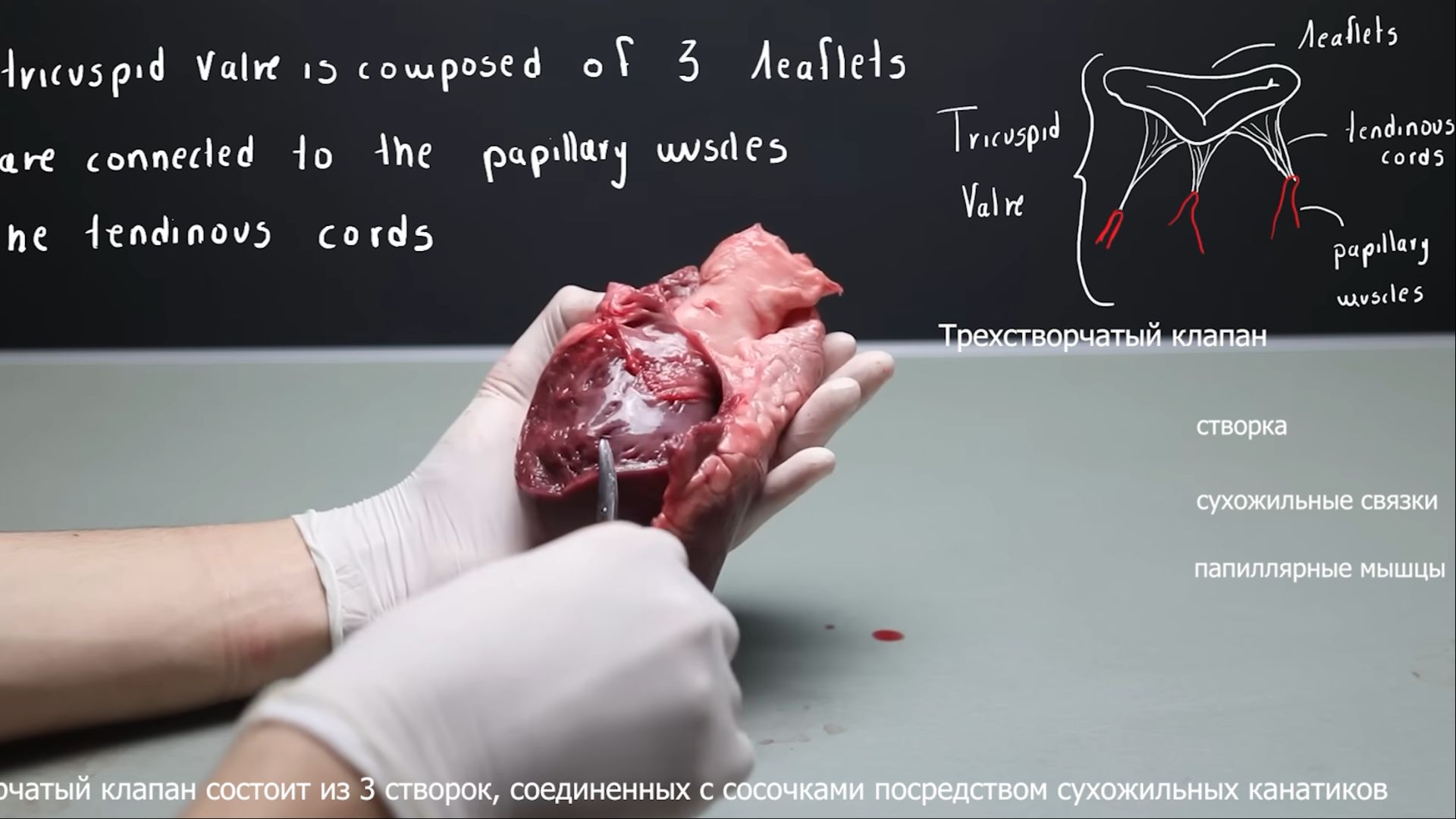 Вскрытие сердца