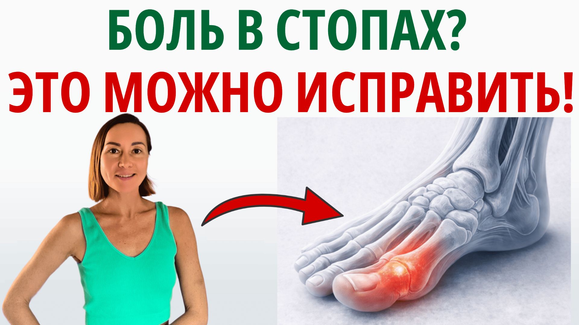 ВАЛЬГУС, ФАСЦИИТ, СУДОРОГИ в ногах — как избавиться? ЭФФЕКТИВНЫЕ МЕТОДЫ без операции