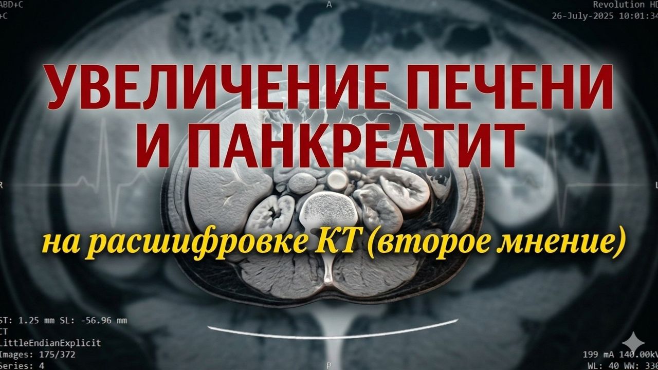 УВЕЛИЧЕНА ПЕЧЕНЬ хронический ПАНКРЕАТИТ ГЕПАТОМЕГАЛИЯ на расшифровке КТ брюшной полости с контрастом