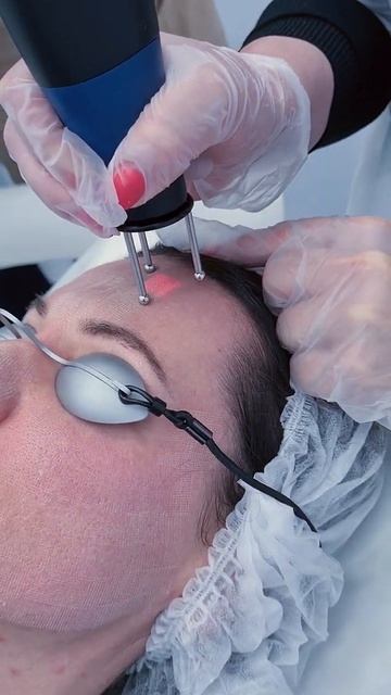 Мягкая неглубокая шлифовка при воспалениях