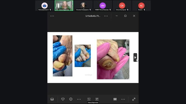 Выезд подолога на дом к пожилым людям или работа в кабинете с очень возрастными клиентами
