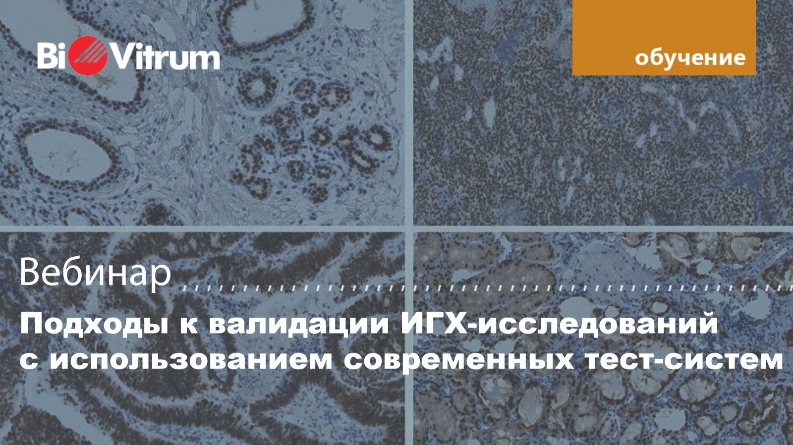 Подходы к валидации иммуногистохимических исследований с использованием современных тест-систем