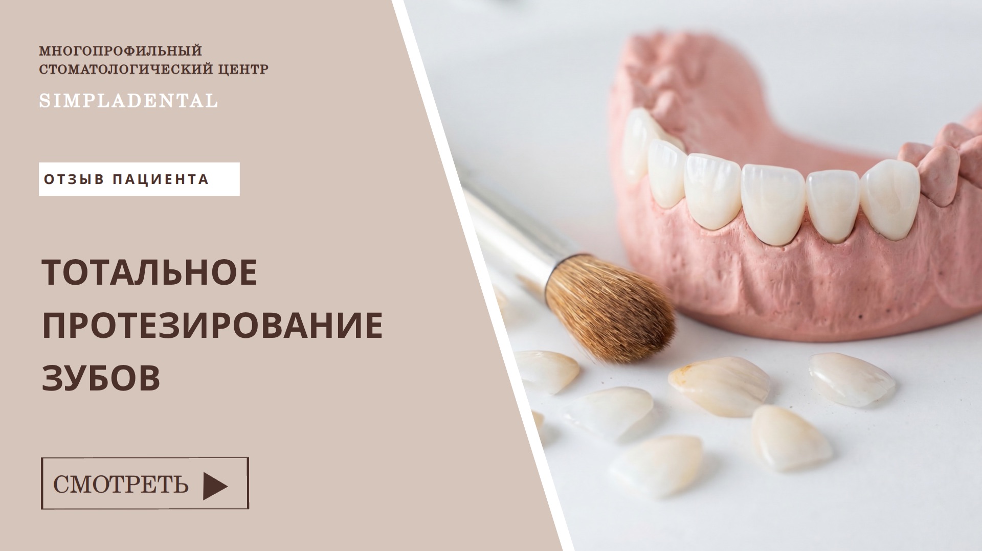 Тотальное протезирование зубов. Отзыв пациента.