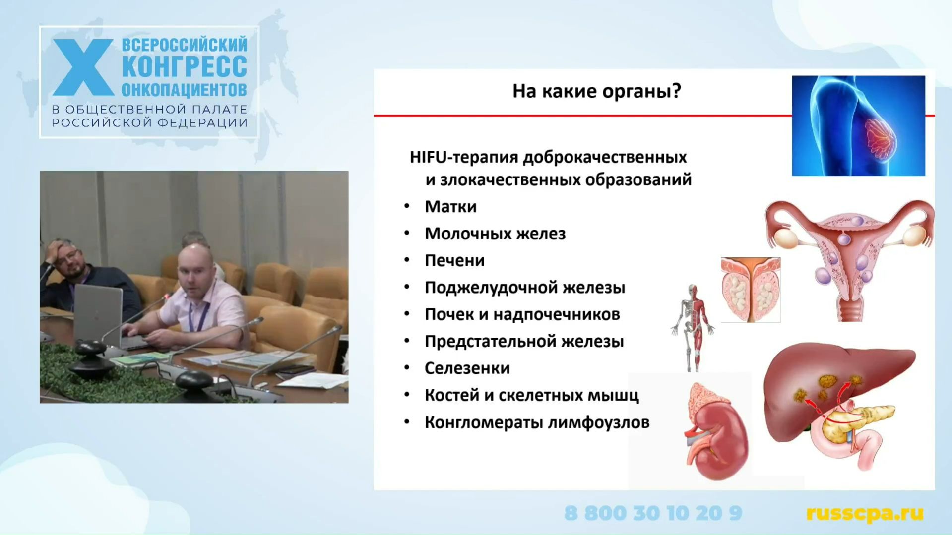 ПРИМЕНЕНИЕ HIFU ТЕРАПИИ ПРИ ЗЛОКАЧЕСТВЕННЫХ ОБРАЗОВАНИЯХ ЖКТ: ПЛЮСЫ, МИНУСЫ, ОПЫТ // КОЧНЕВ Д.В.