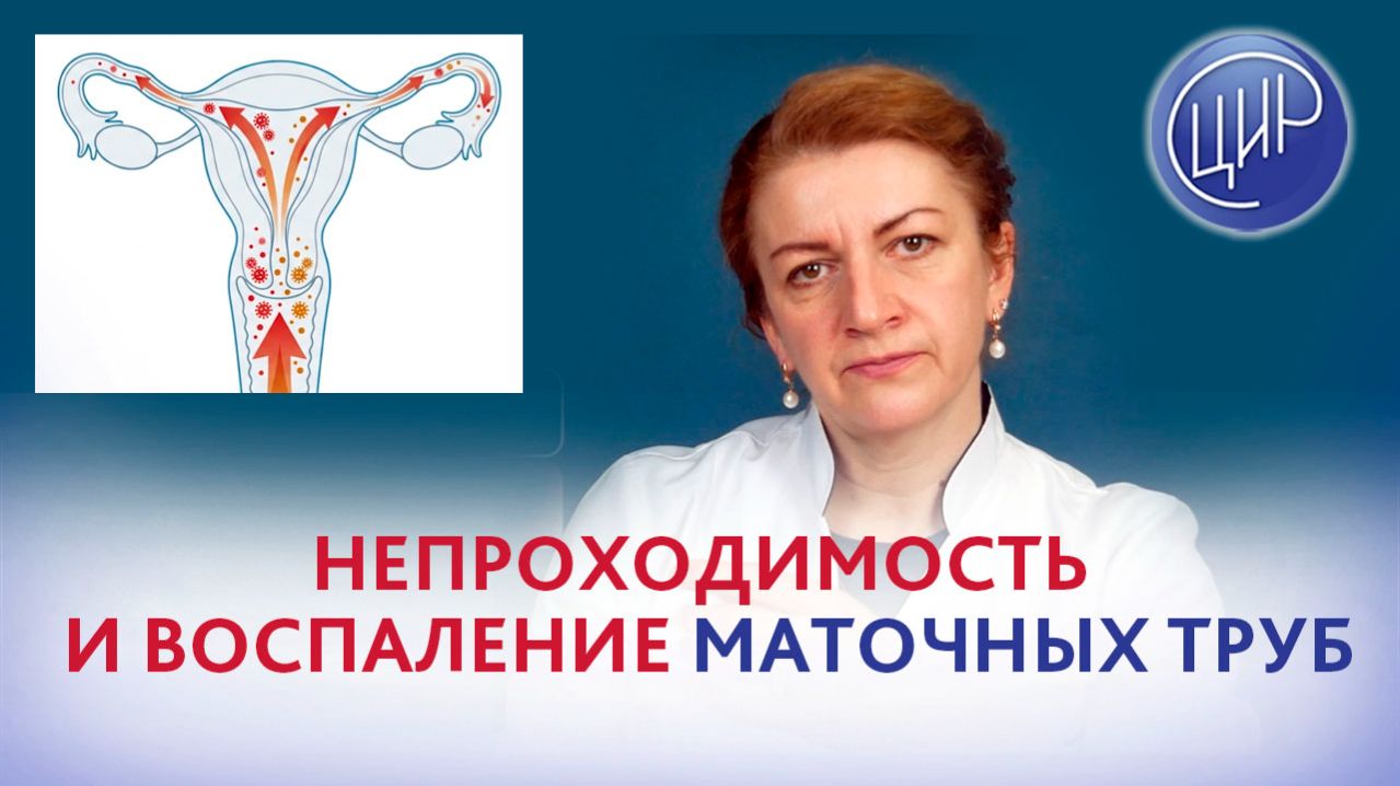 Воспалительные процессы и непроходимость маточных труб.