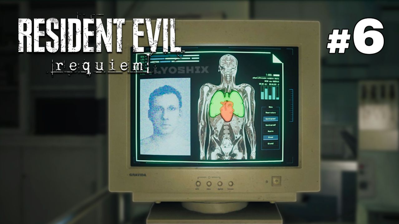 ТРАНСПЛАНТАЦИЯ ОРГАНОВ – Resident Evil Requiem #6