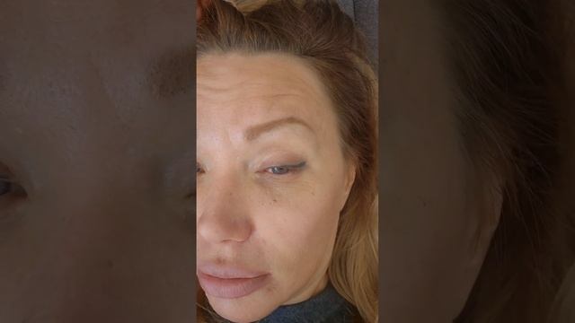 Eolina S/Мне сделали операцию. Лежу и Болтаю.