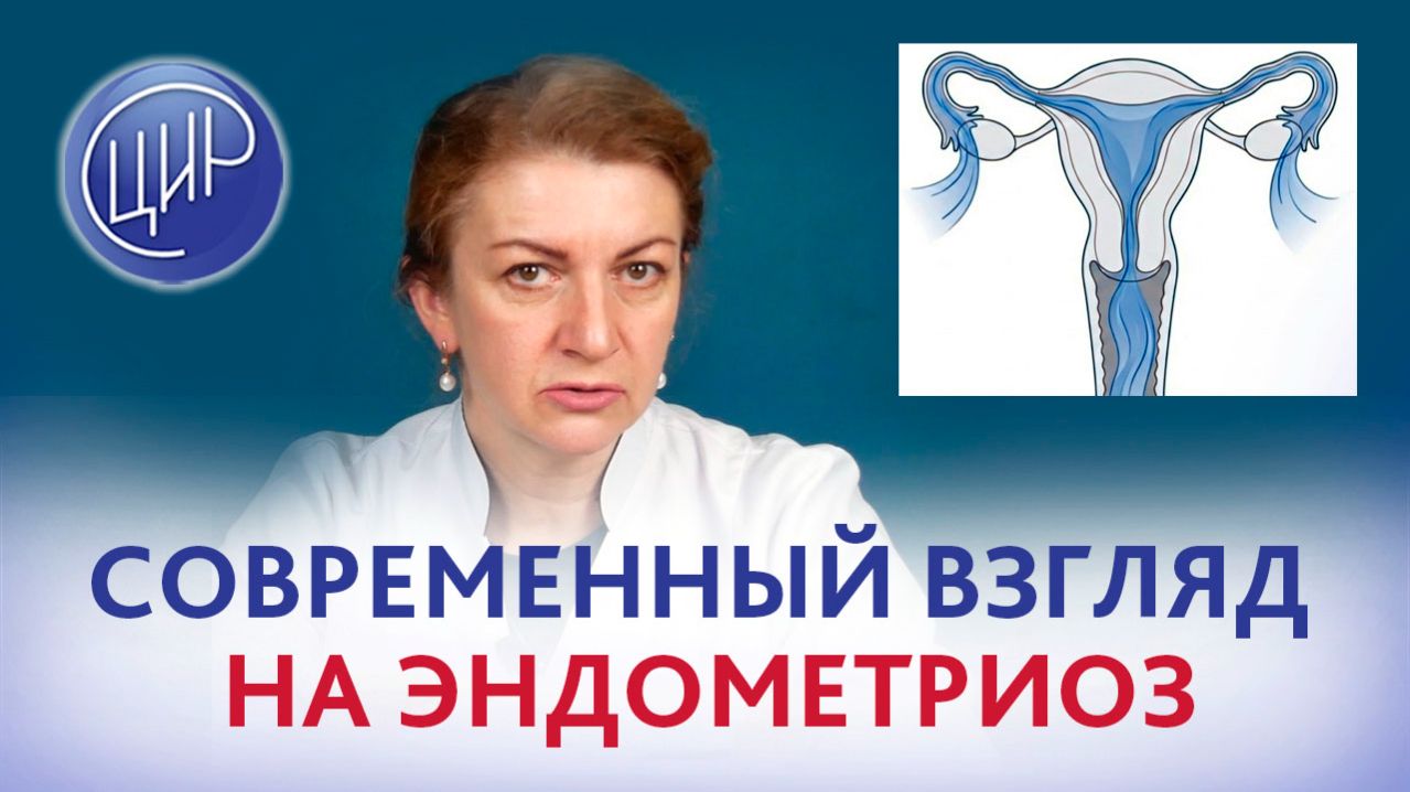 Эндометриоз: причины возникновения и современный взгляд на проблему. Дементьева С.Н.