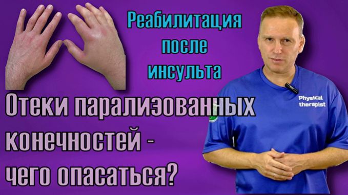 Отеки парализованных конечностей - в чем опасность, как бороться.