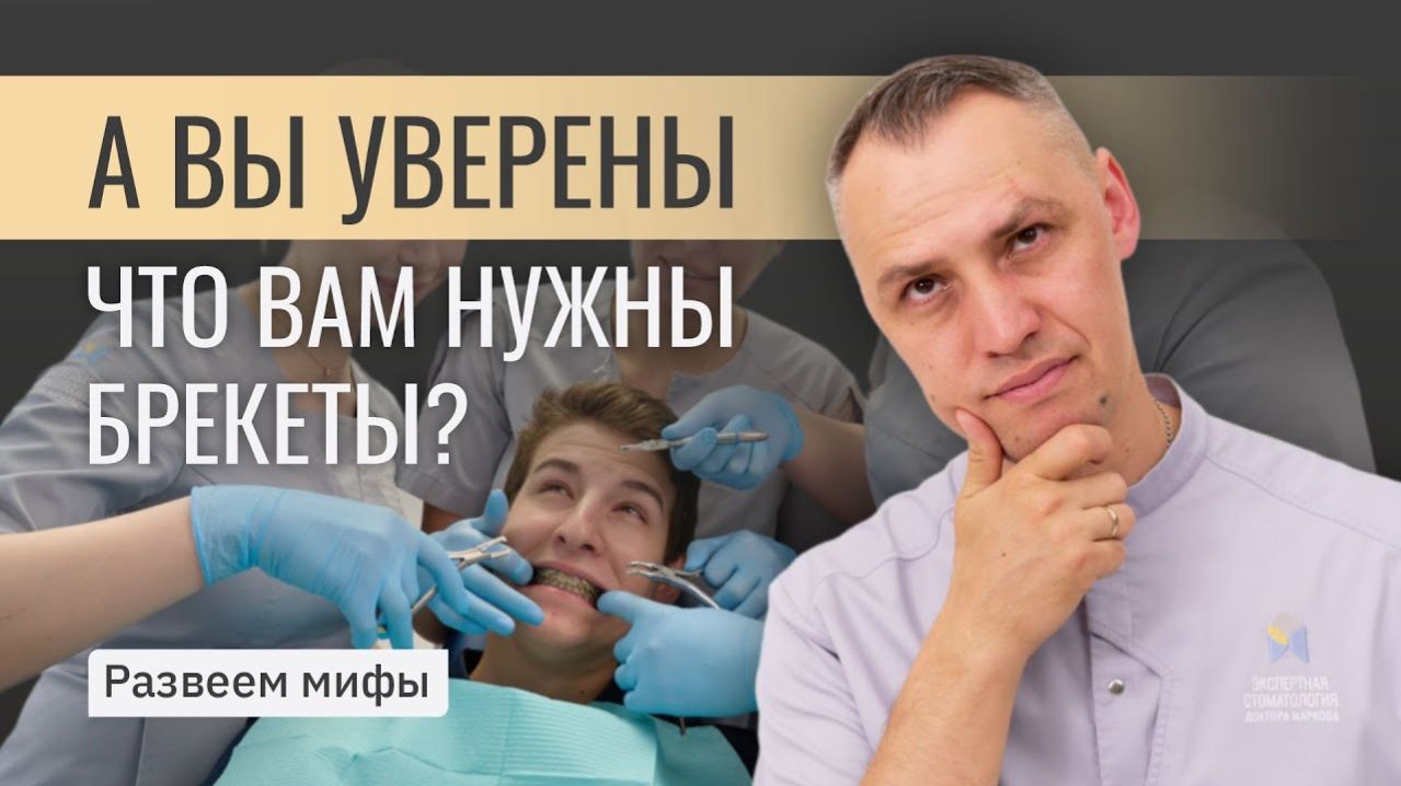 А ВЫ УВЕРЕНЫ ЧТО ВАМ НУЖНЫ БРЕКЕТЫ? Развеем мифы
