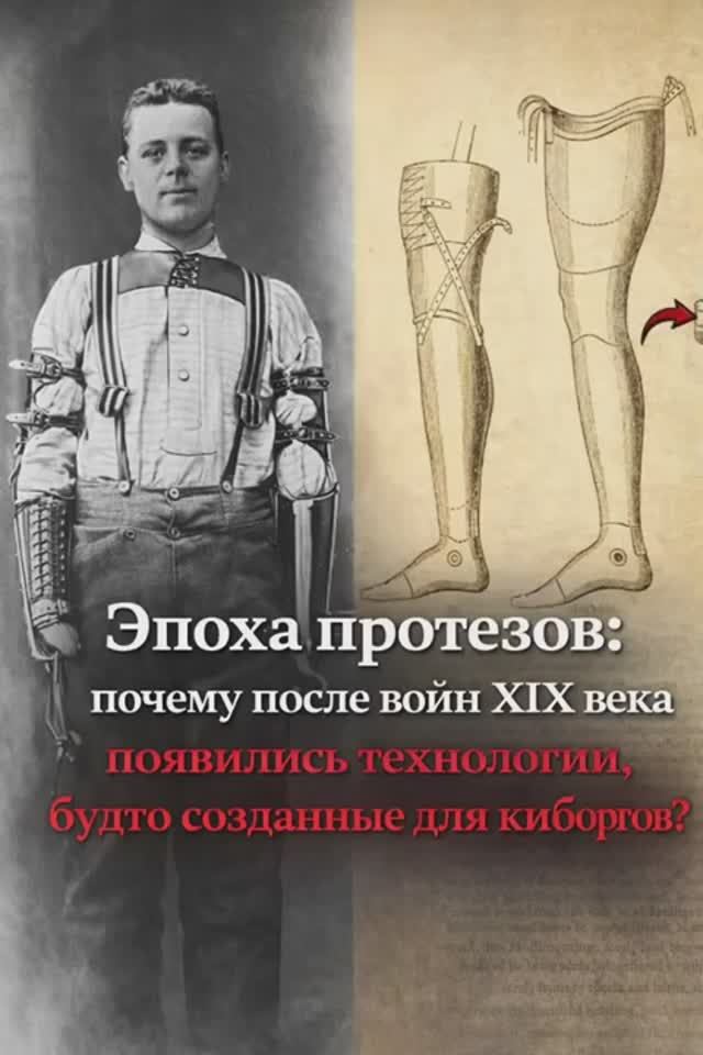 Эпоха протезов : почему после воин 19 века появились технологии будто для киборгов ? Часть 1/2