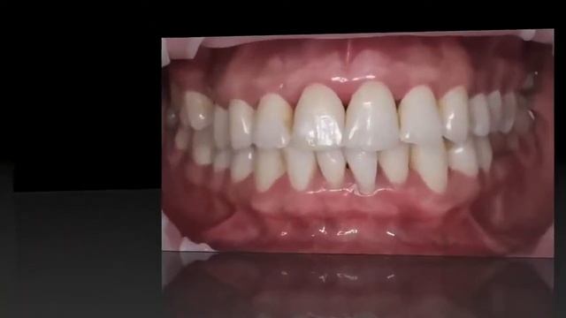 M-Chip применение.