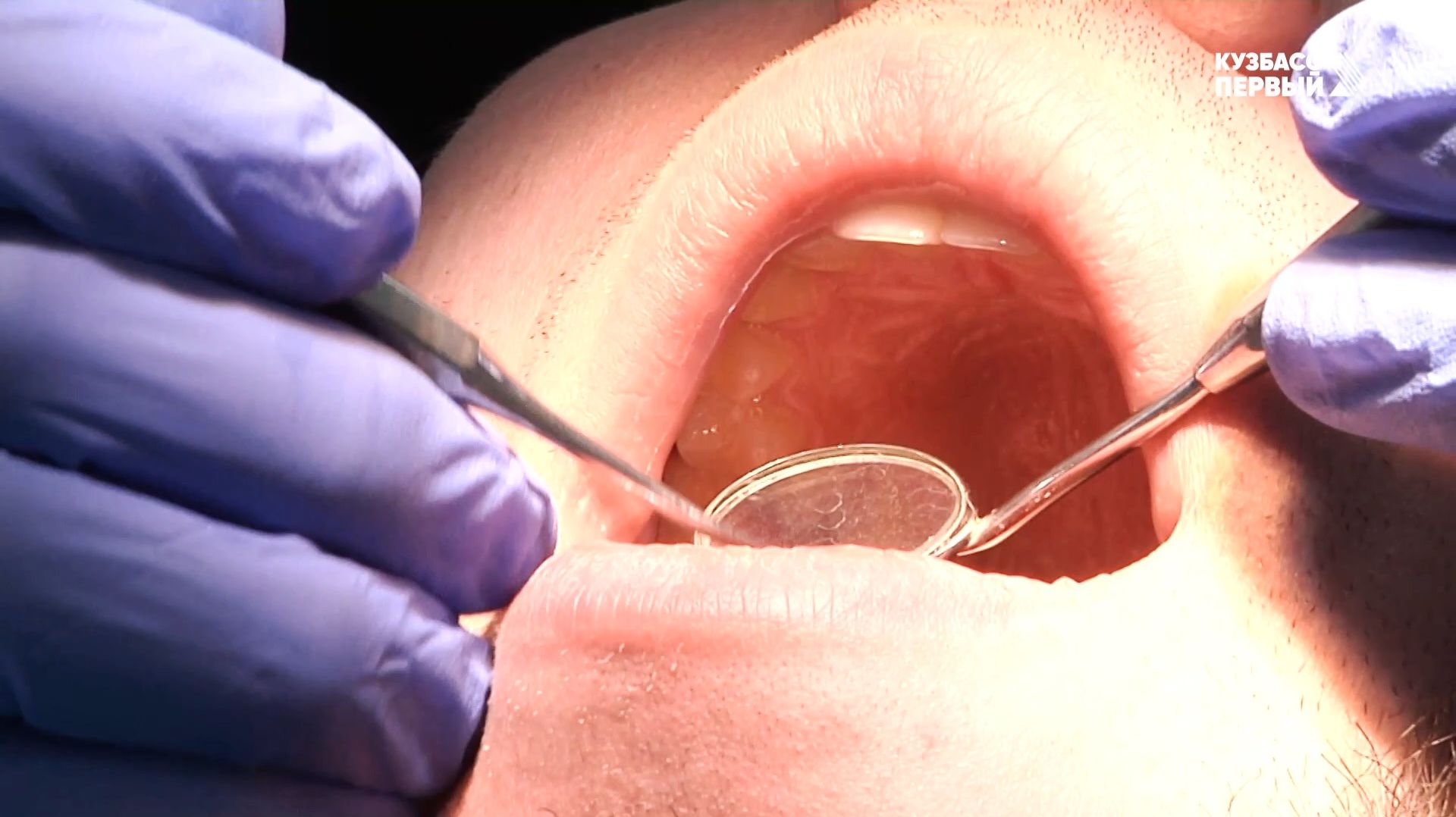 Здоровая улыбка России. Кому и как часто нужно приходить на профессиональную гигиену полости рта?