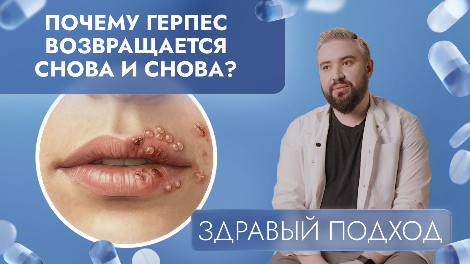 Почему герпес возвращается снова и снова? | Здравый подход (2026)