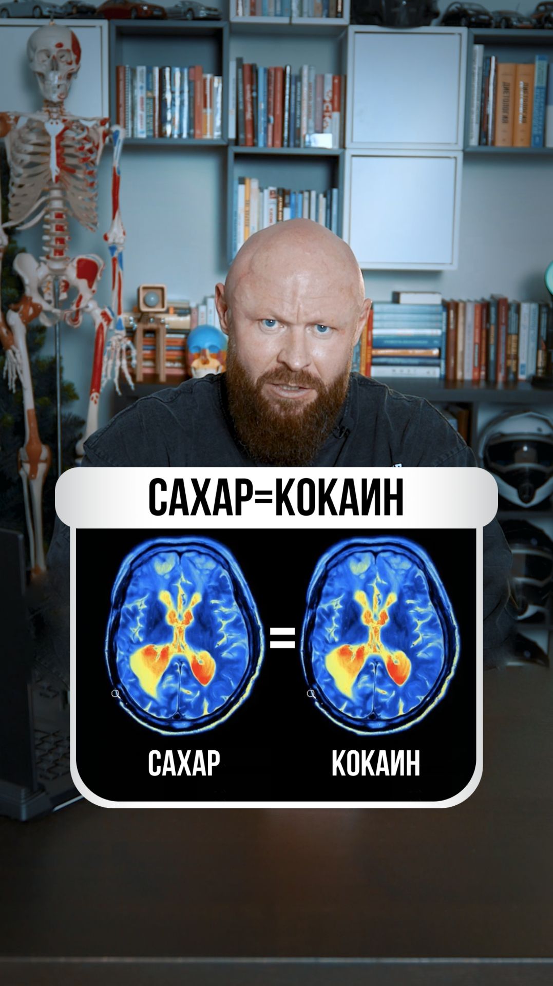 Почему Врачи ВРУТ про Сахар? #наука #здоровье #диета