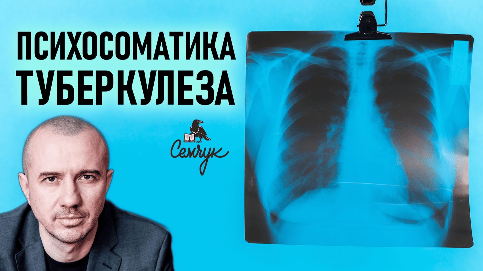 Как апатия приводит к туберкулезу. Характер палочки Коха. Феноменальная психосоматика