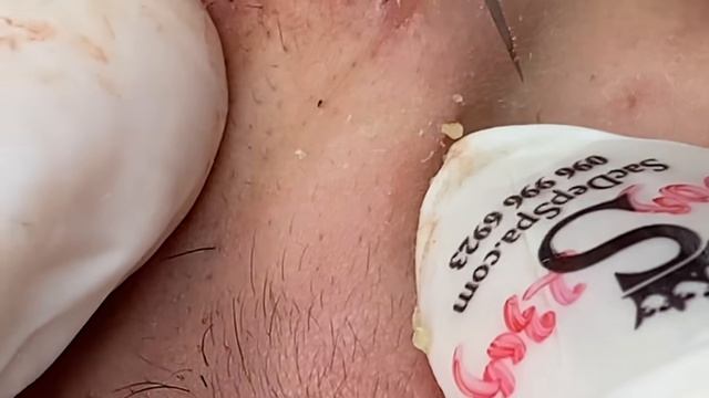 004 • Relax Spa • АСМР • Acne collection