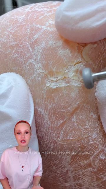 глубокие трещины на пятках, какие фрезы использую я ❤️