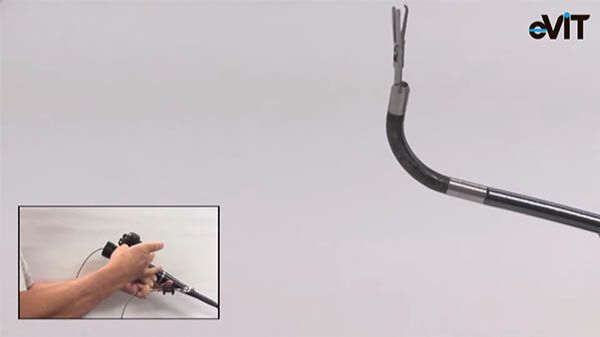 Инструмент для извлечения eVIT - управляемая направляющая с инструментальным каналом