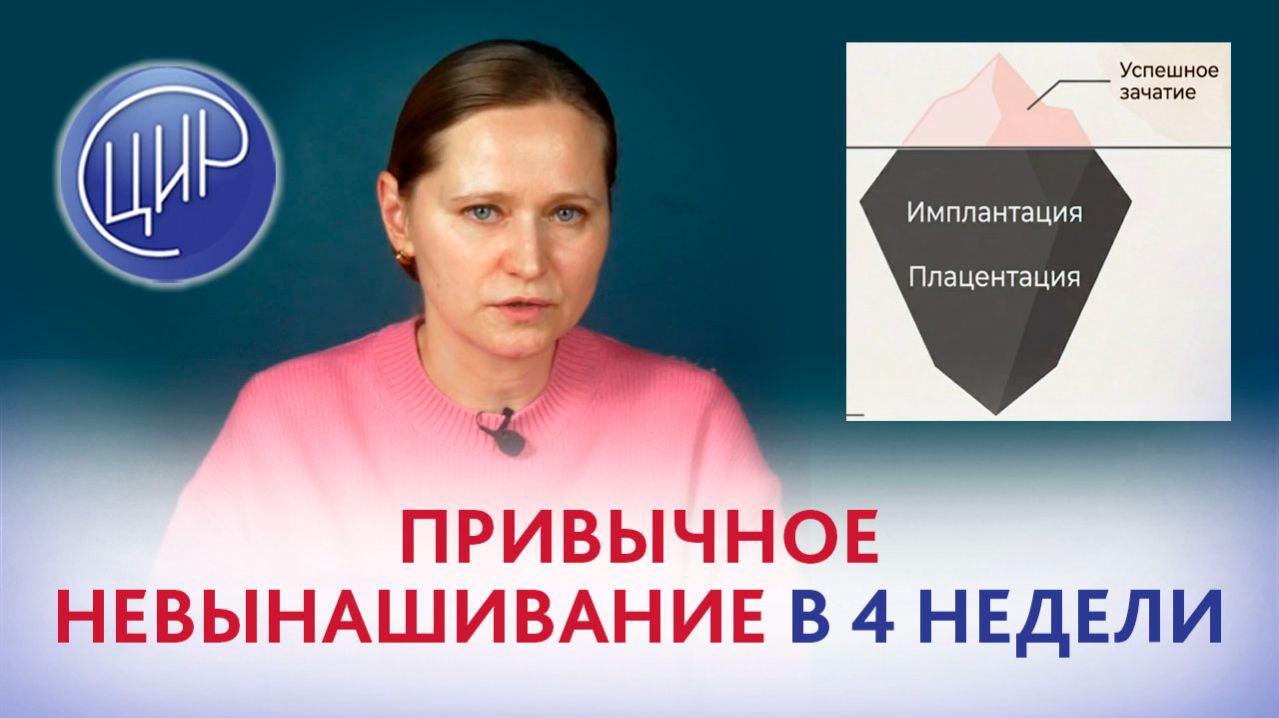 Беременность наступает, но замирает в течение 4 недель Тимофеева О.В.