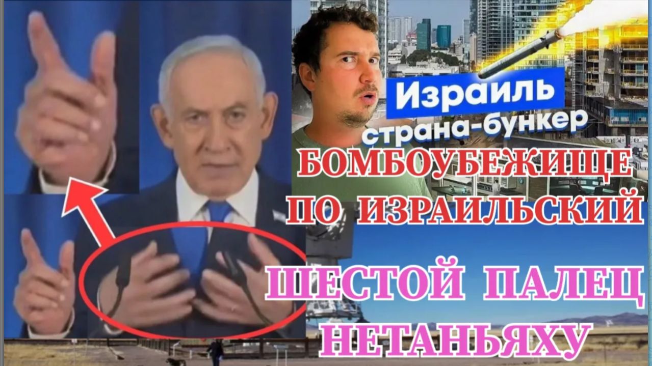 ИЗРАИЛЬСКИЙ ПРЕМЬЕР ОТРАСТИЛ ШЕСТОЙ ПАЛЕЦ