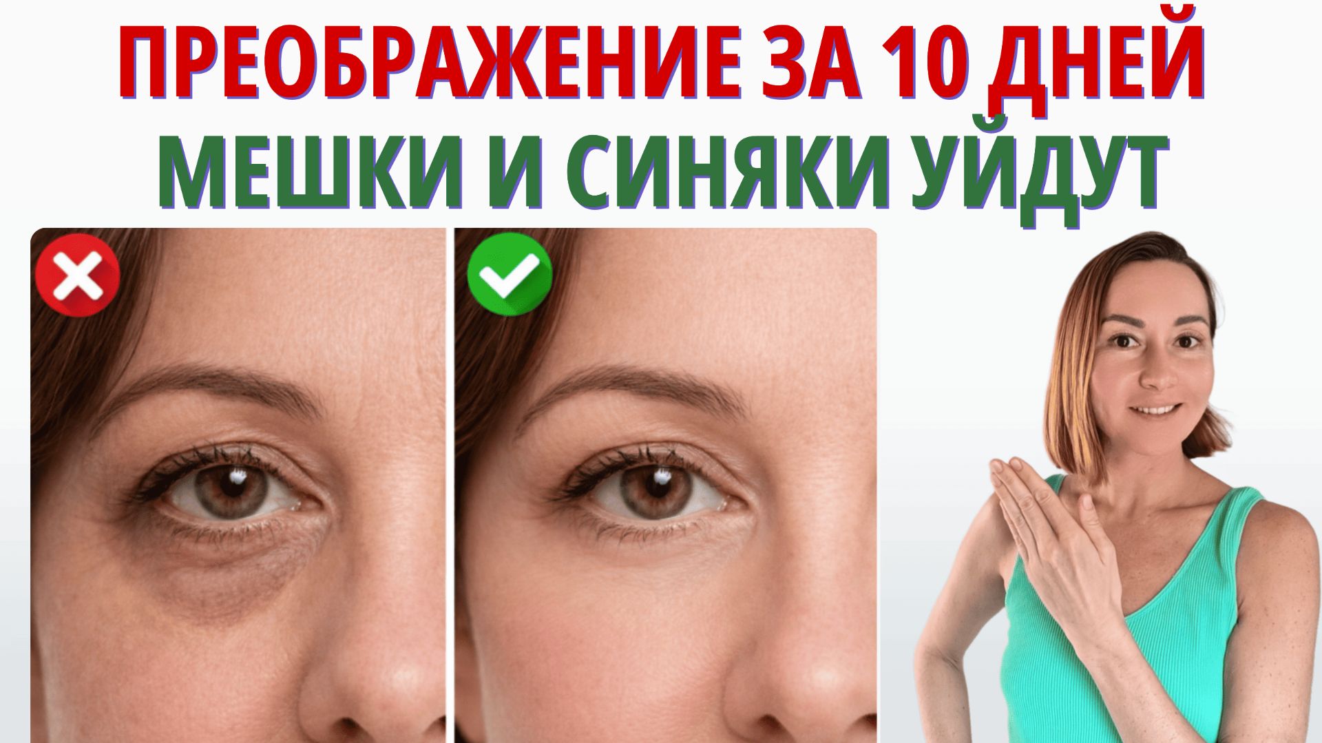 Как убрать мешки грыжи синяки под глазами без уколов: 5 минут в день