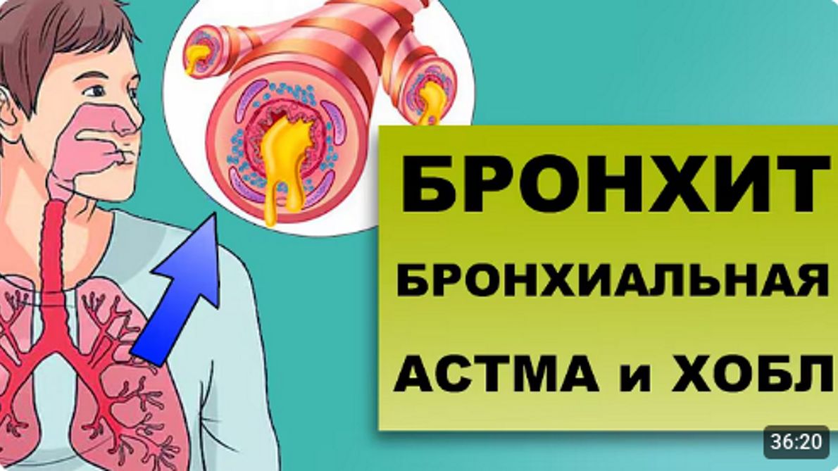 БРОНХИАЛЬНАЯ АСТМА и ХОБЛ. Все о заболеваниях