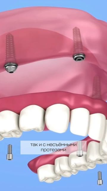 Стоматолог - ортопед Пузик Алекйсей Дмитриевич
