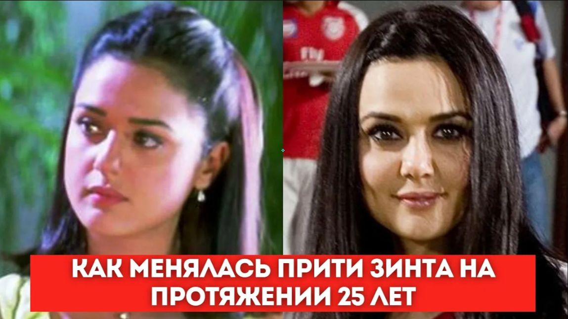Как менялась Прити Зинта на протяжении 25 лет.