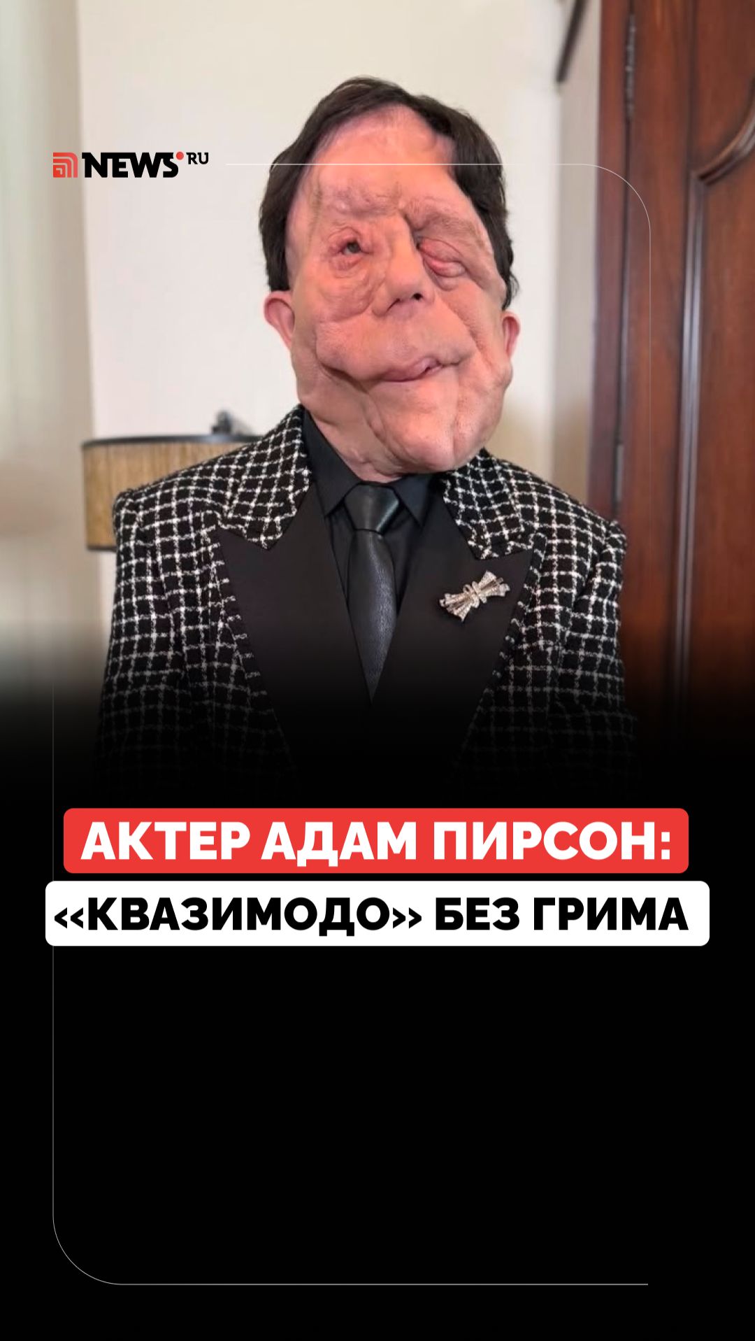 Чем болен актёр Адам Пирсон и как попал в кино?