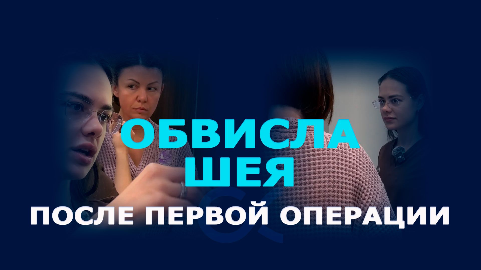 Круговая подтяжка лица и шеи: реабилитация по этапам и итог через полгода