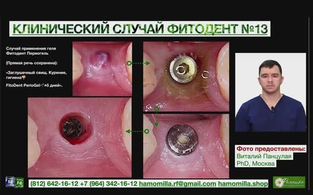 Метаболический менеджмент мягких тканей Часть 8