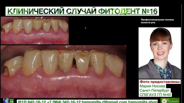 Метаболический менеджмент мягких тканей Часть 7