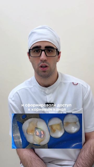 Воспаление давно не всегда является показанием к удалению зуба | кейс