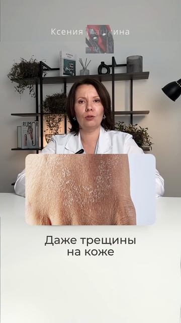 У вас дефицит витамина А 🙀🫶🤯