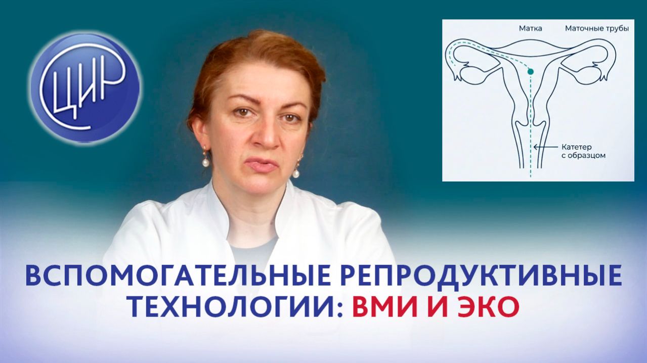 Вспомогательные репродуктивные технологии: внутриматочная инсеминация и ЭКО.