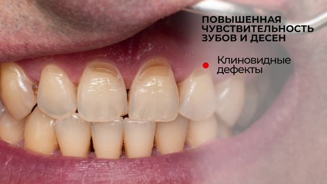 Показания к применению - зубная щетка redox с электрическими витаминами с мягкой щетиной